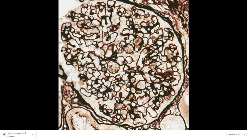 Histotecnologia - 100% online - IPESSP